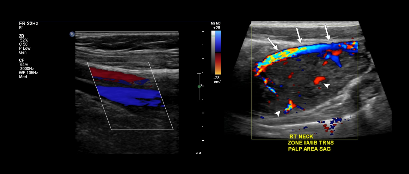 Color Doppler: Modern Diagnostic Centre, Kottayam